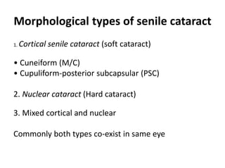 senile cataract.pptx