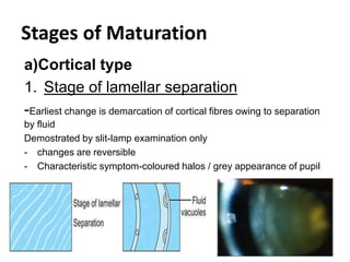 senile cataract.pptx