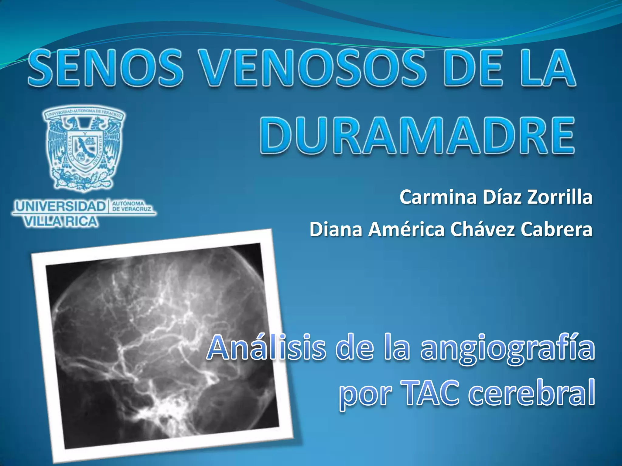 ANATOMIA DE LOS SENOS VENOSOS DE LA DURAMADRE | PPTX