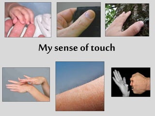 Senses hot cold | PPTX | Brain and Nervous System Disorders | Diseases ...