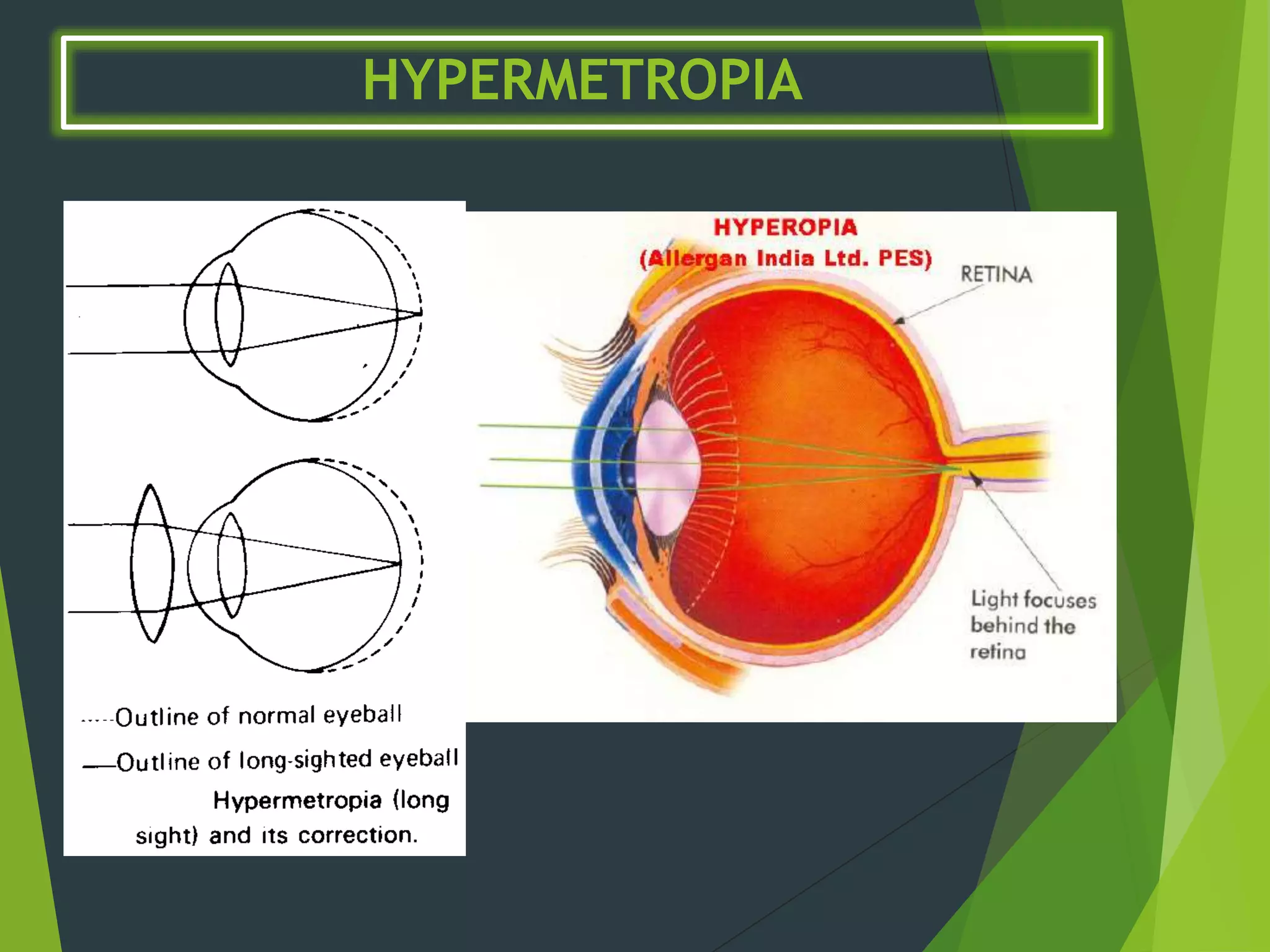 sense vision.pptx