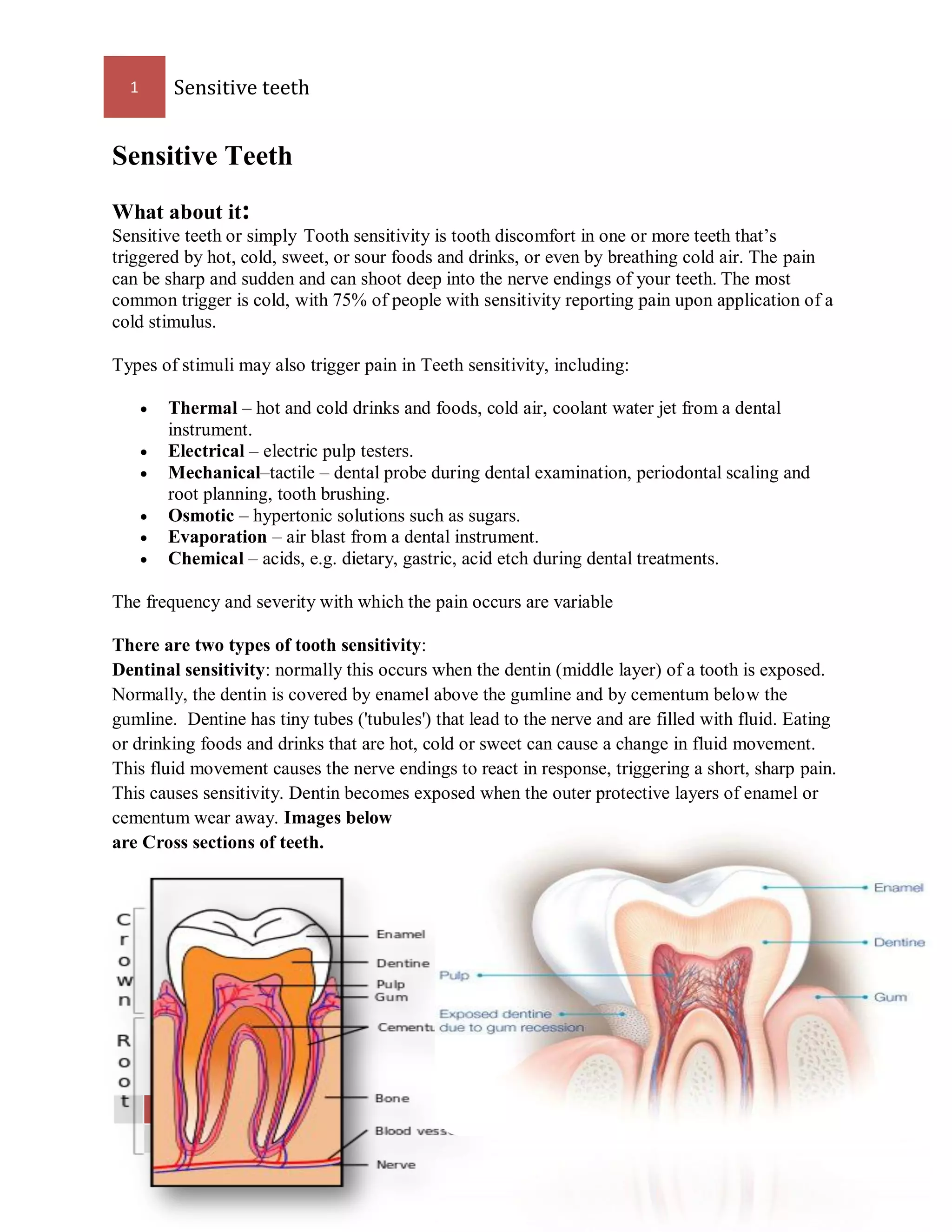 Sensitive teeth | PDF