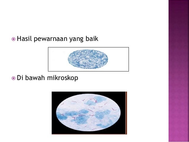 Sensitivitas tes, pewarnaan bta & Identifikasi strepto staphylo