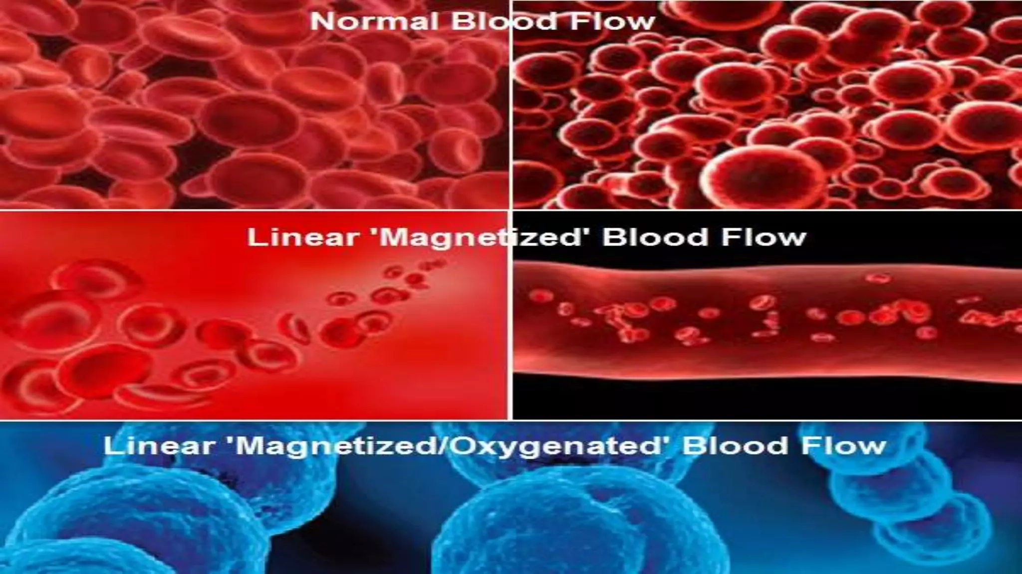 Blood Flow Sensors and Meters with their working | PPTX