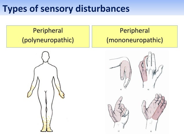 Sensory disturbances