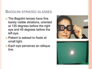 Sensory evaluation of squint | PPTX