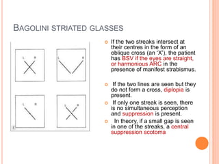 Sensory evaluation of squint | PPTX