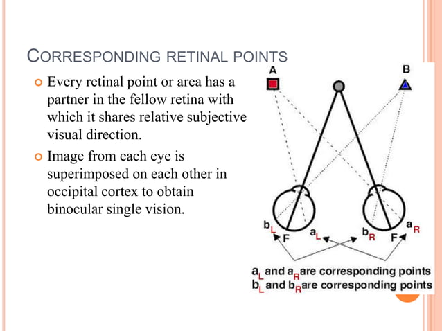 Sensory evaluation of squint | PPTX | Eye and Vision Conditions ...