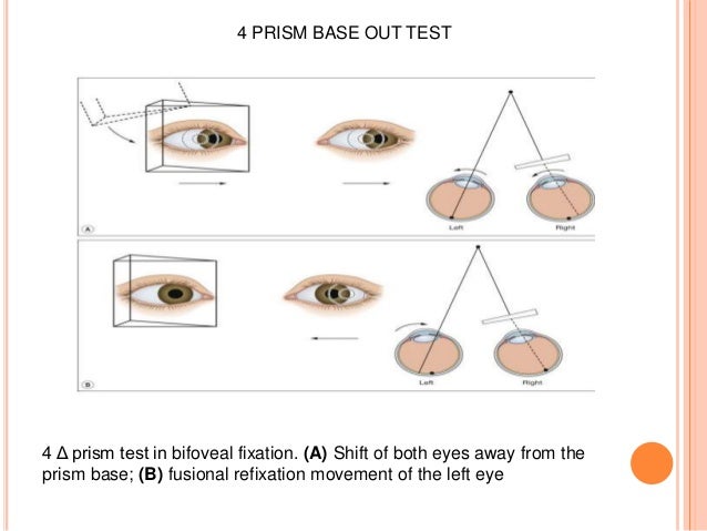 Sensory evaluation of squint