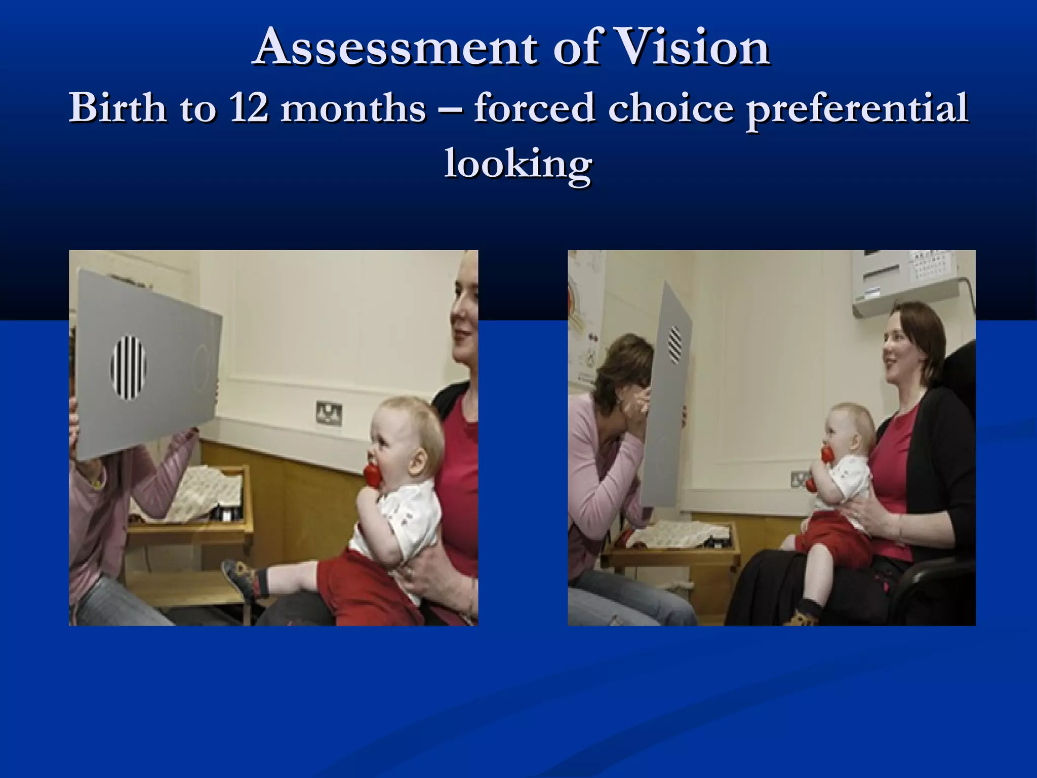 Sensory & motor evaluation of strabismus | PPT