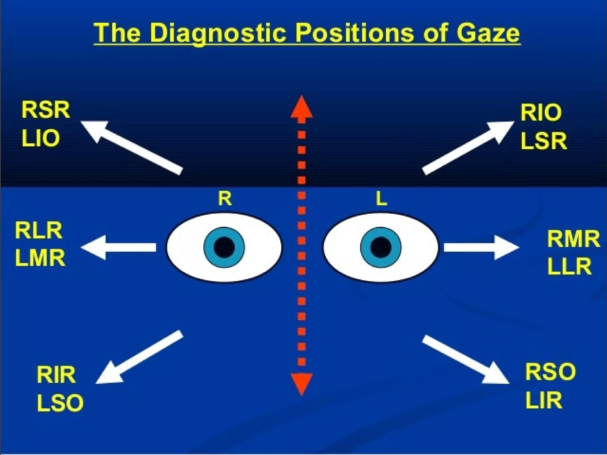 Sensory & motor evaluation of strabismus | PPT