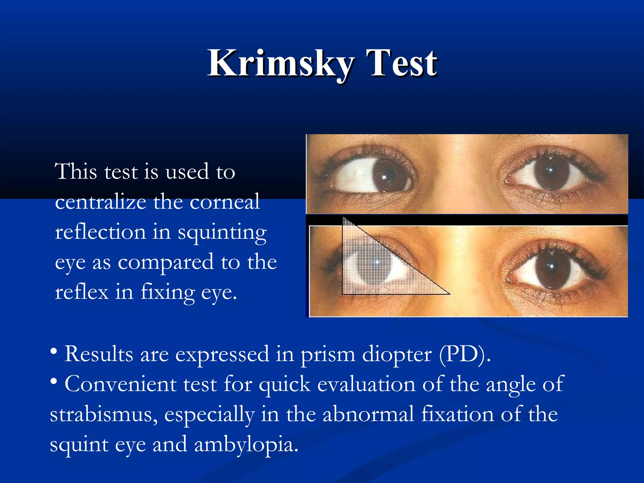 Sensory & motor evaluation of strabismus | PPT