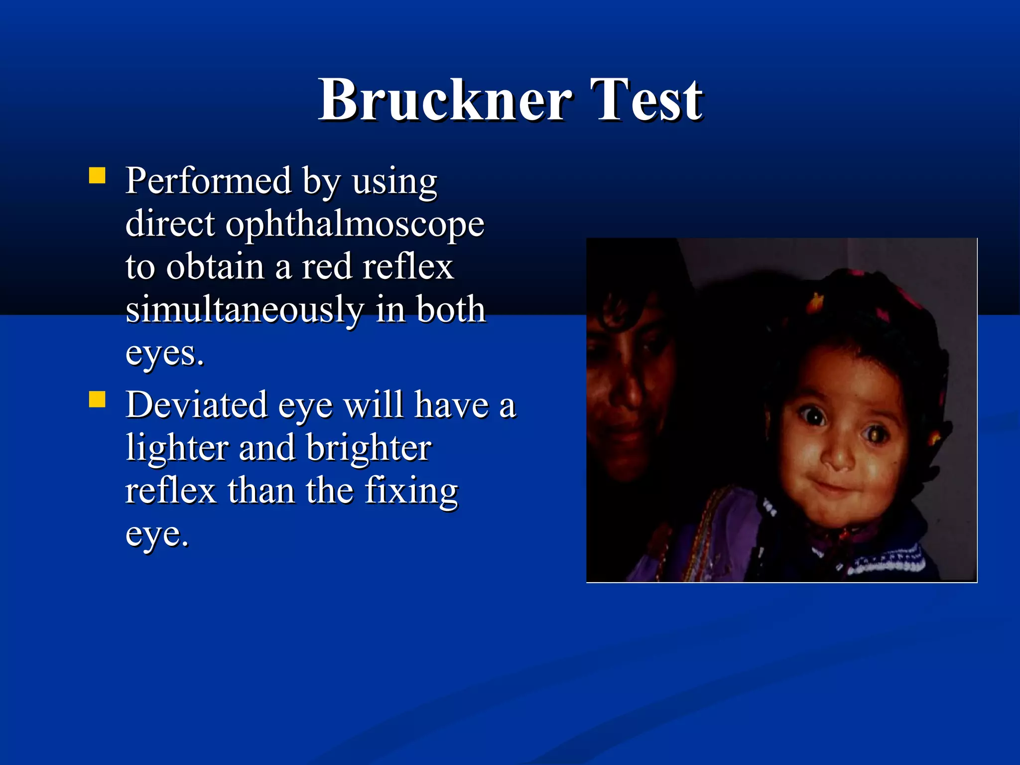 Sensory & motor evaluation of strabismus | PPT