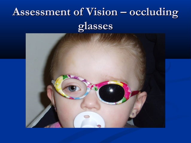 Sensory & motor evaluation of strabismus | PPT | Eye and Vision ...