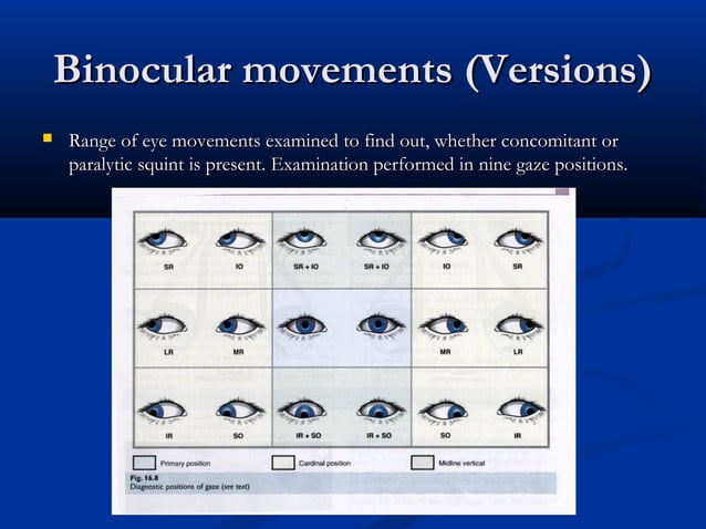 Sensory & motor evaluation of strabismus | PPT | Eye and Vision ...