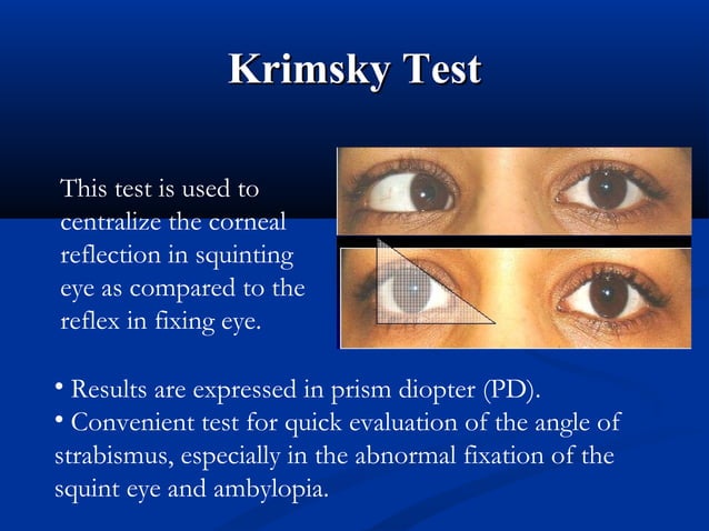 Sensory & motor evaluation of strabismus | PPT | Eye and Vision ...