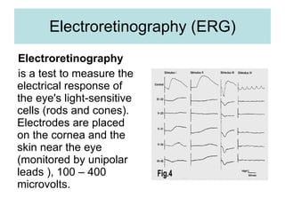 Sensory perceptionexaminationandaids fin | PPT