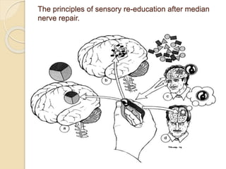 Sensory Re-education | PPTX