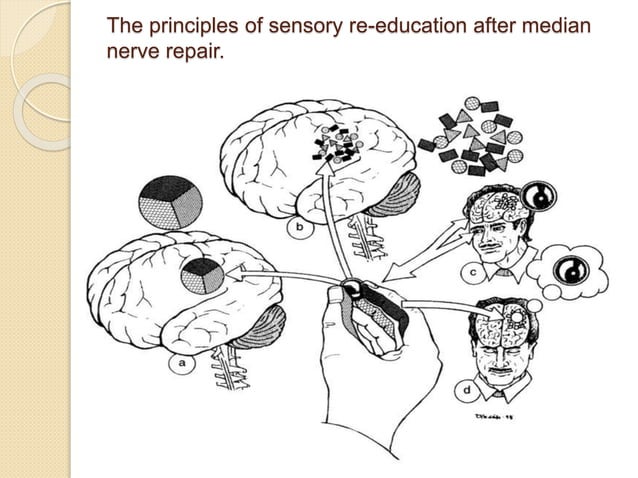 Sensory Re-education | PPTX | First Aid | Injuries