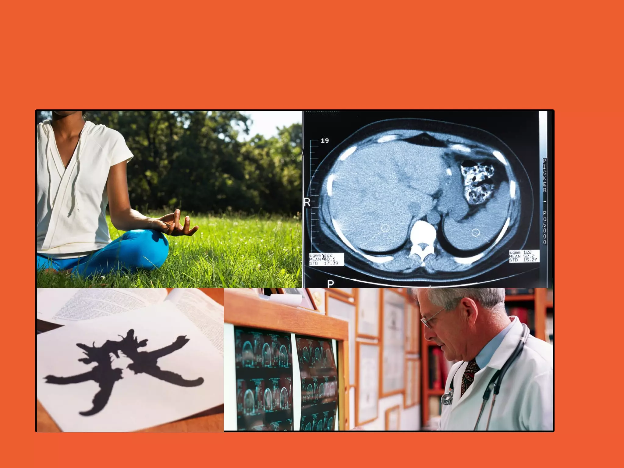 Sensory subsitution and augmentation | PPT