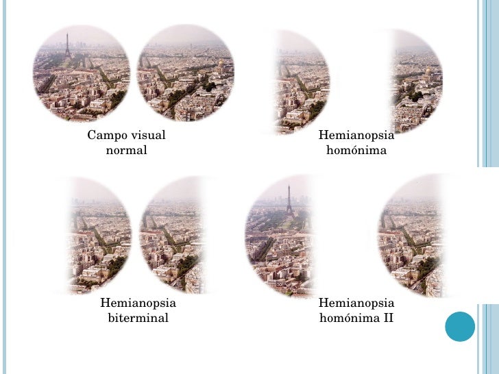 Sentido De La Vista 2