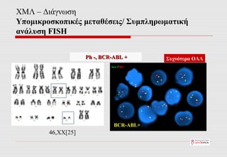 Chronic Myeloid Leukemia (CML) Cytogenetic diagnosis and follow up | PPT