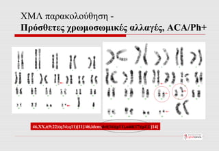Chronic Myeloid Leukemia (CML) Cytogenetic diagnosis and follow up | PPT
