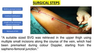 Sephaneous vein graft for anterior urethral stricutre | PPTX