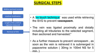 Sephaneous vein graft for anterior urethral stricutre | PPTX