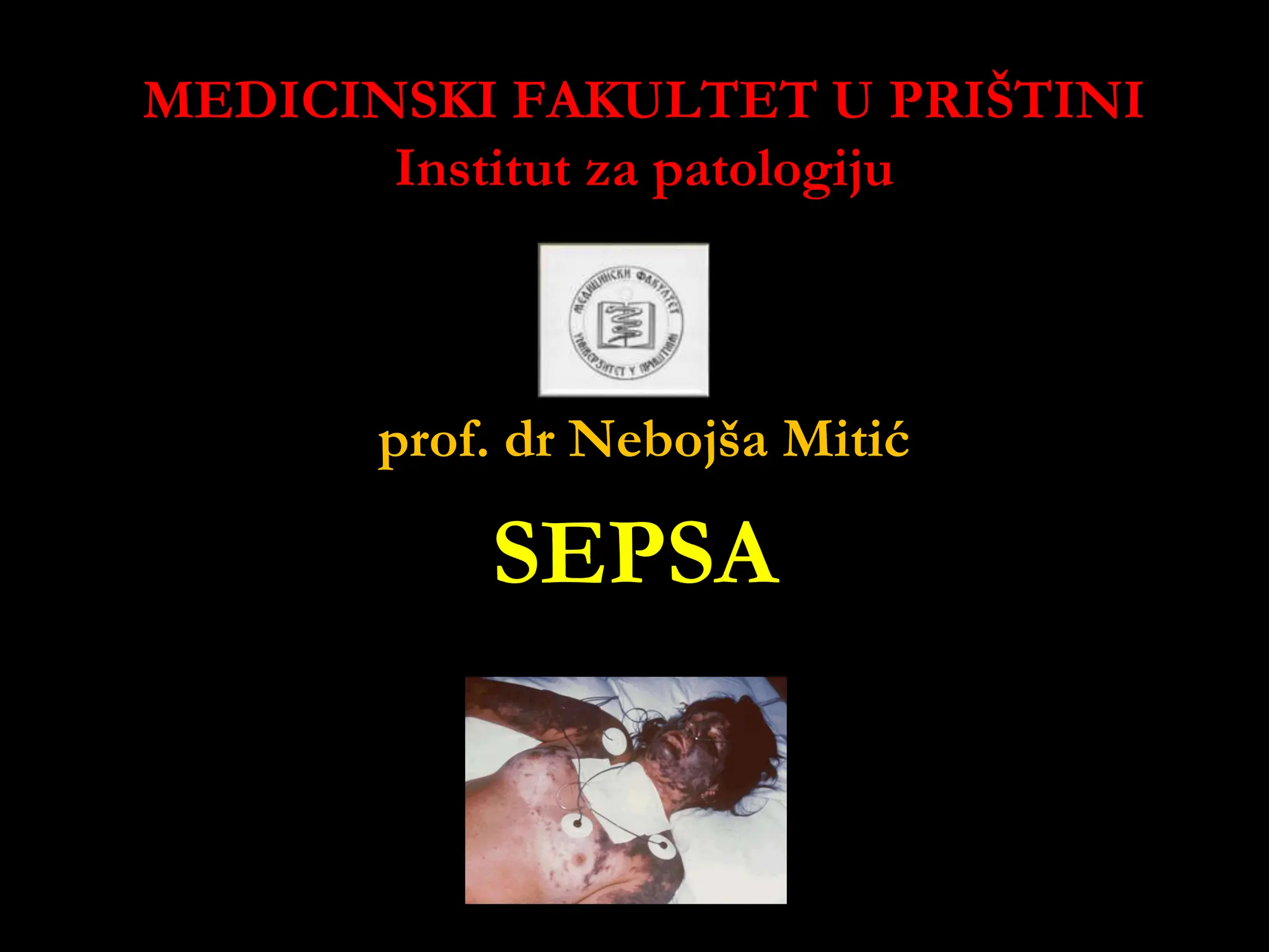 Sepsa.pptxfdfdfddfajsjksajkasjsajsjajkjasjaj | PPT