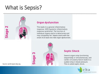 Sepsis-101.pptx | First Aid | Injuries