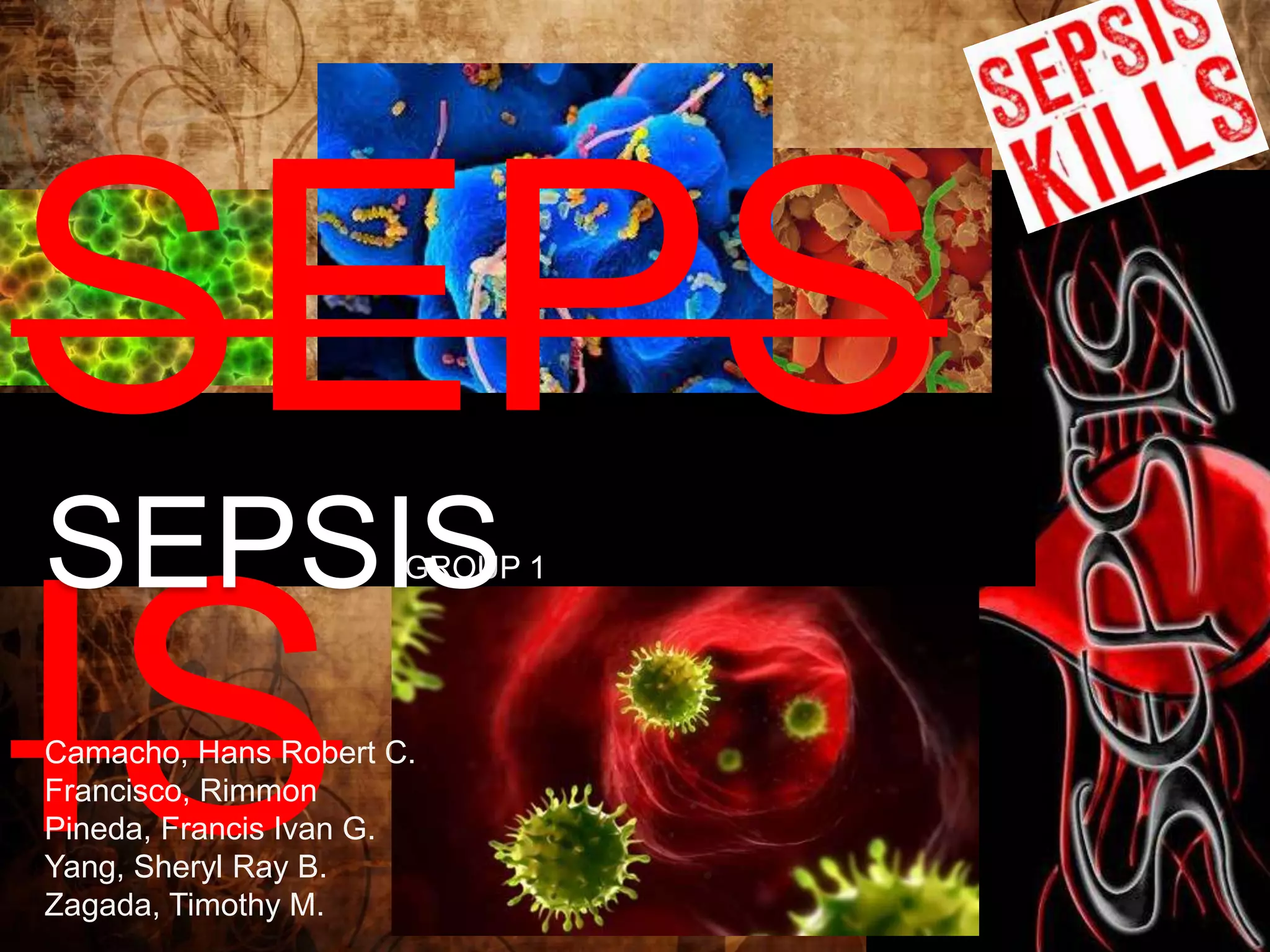 Sepsis | PPTX