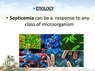 Sepsis | PPTX