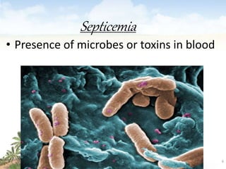 Sepsis | PPTX