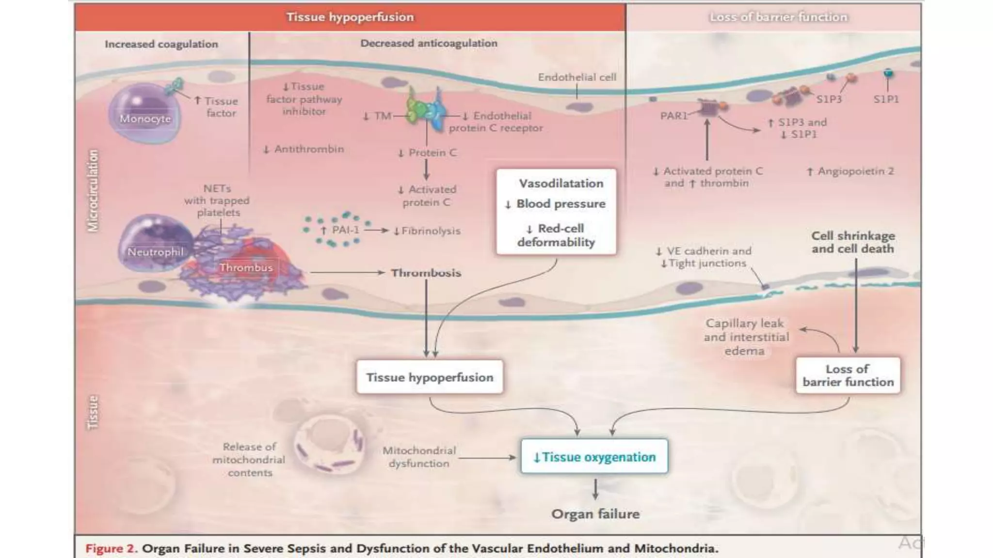 Sepsis | PPT