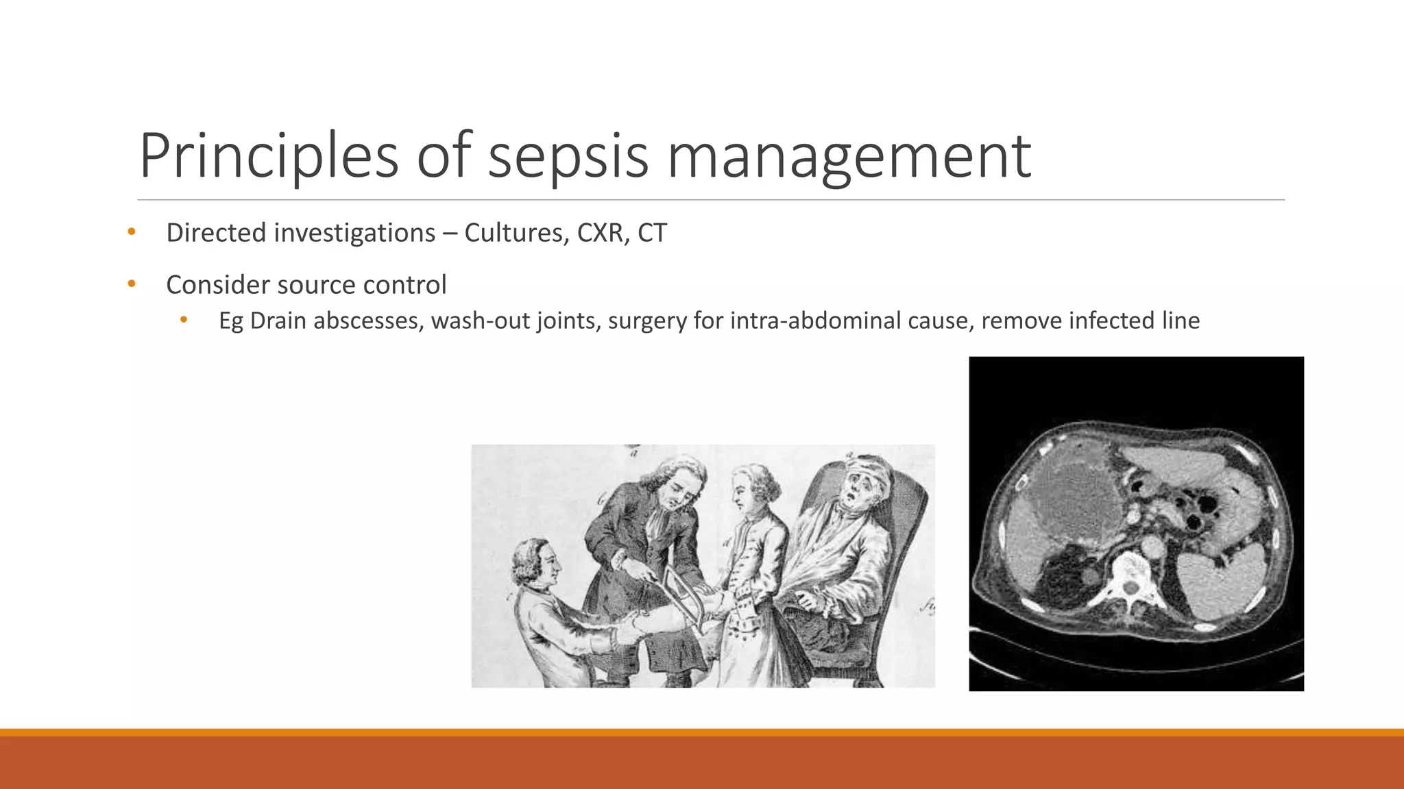 Sepsis.pptx