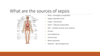 Sepsis.pptx