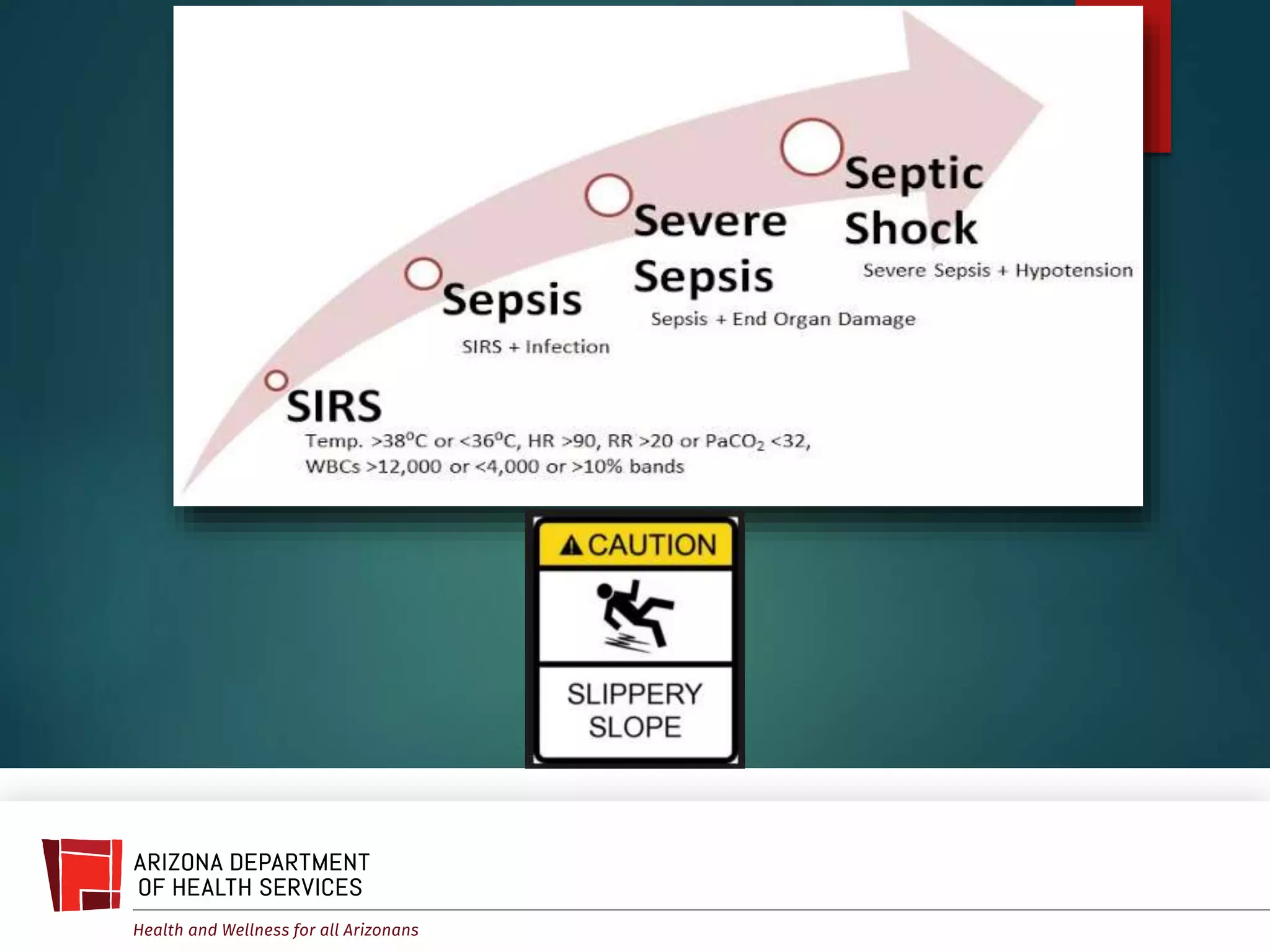sepsis.pptx