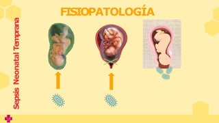 sepsis-neonatal-2020 dr bustamante torrez | PPTX