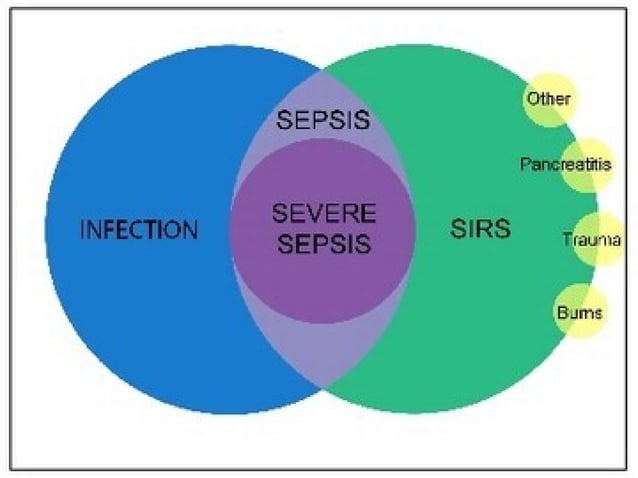 Sepsis and septic shock | PPT