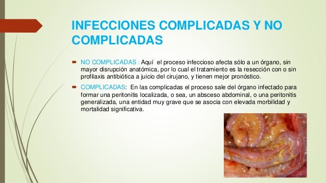 SEPSIS ABDOMINAL