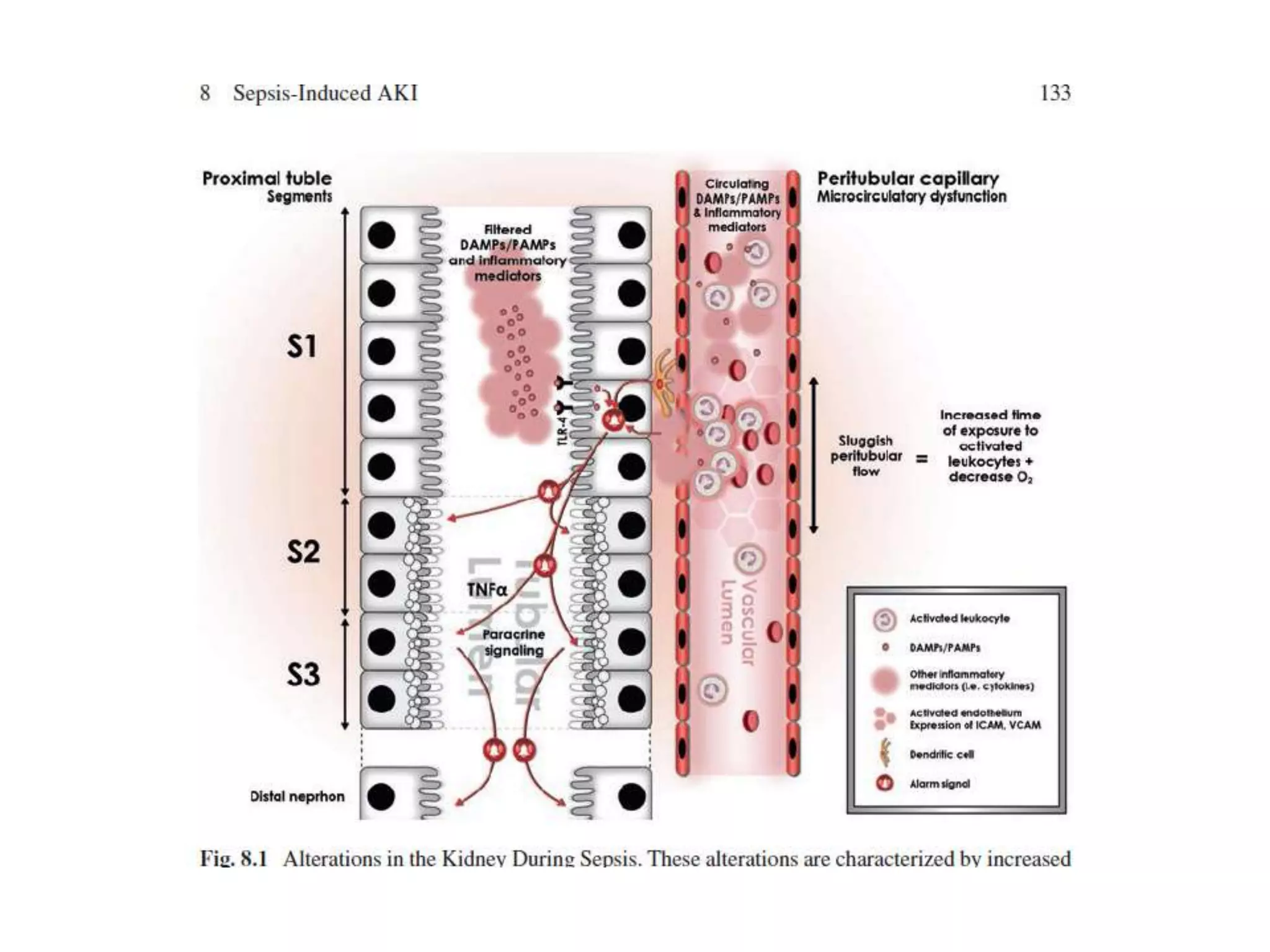 Systemic Inflammatory Response Syndrome SIRS and Septicemia | PPTX