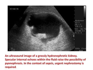 Systemic Inflammatory Response Syndrome SIRS and Septicemia | PPTX