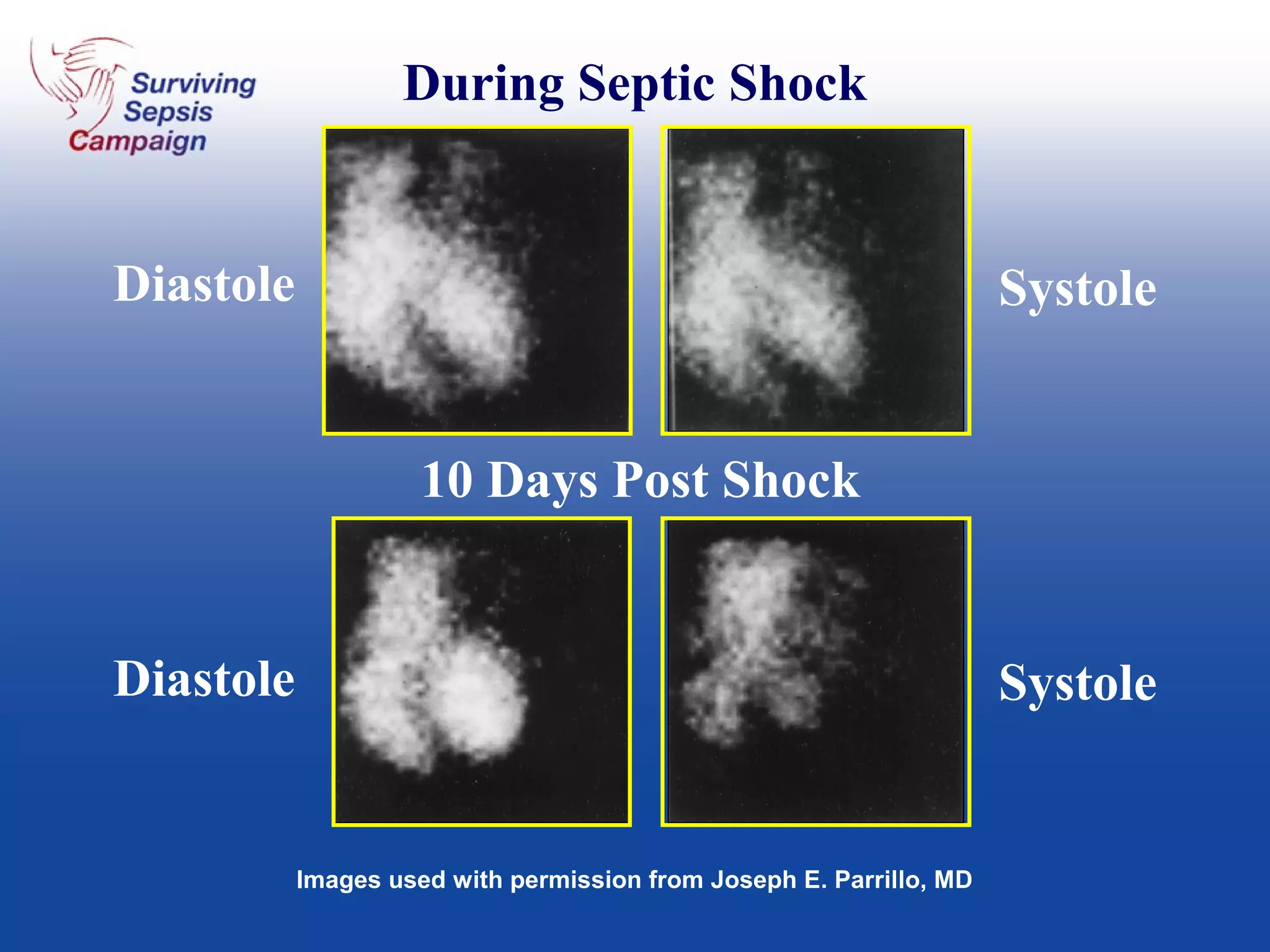 Sepsis guidlines | PPT