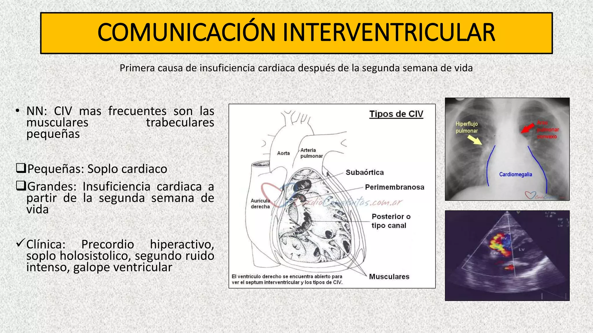 sepsis, hic, civ.pptx