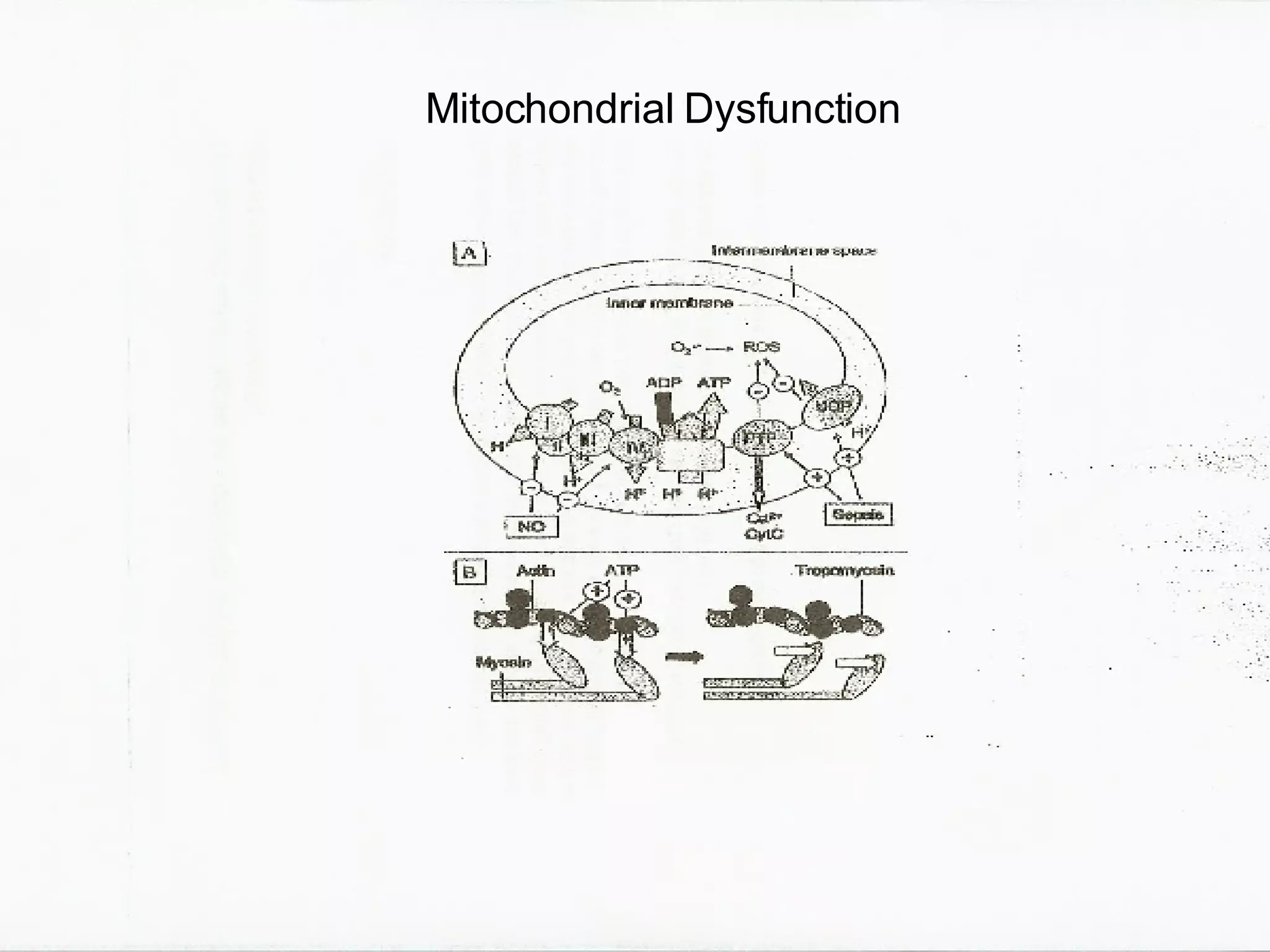 Sepsis-Induced Cardiac Dysfunction | PPT