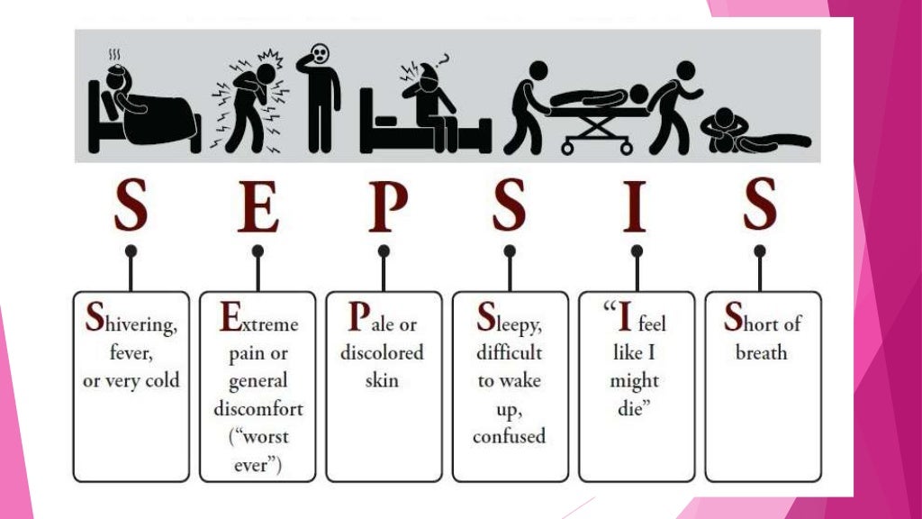 Sepsis in Pregnancy