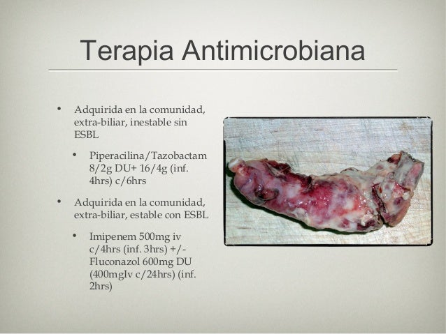 Sepsis intra abdominal