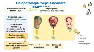 Sepsis neonatal presentacion universidad central | PPTX