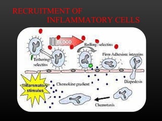 CME: Sepsis Pathogenesis - Host factors | PPT